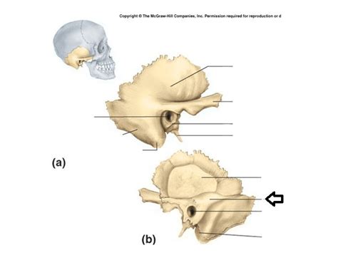 Temporal Bone Diagram Quizlet