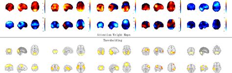 Spatial Temporal Convolutional Attention For Mapping Functional Brain