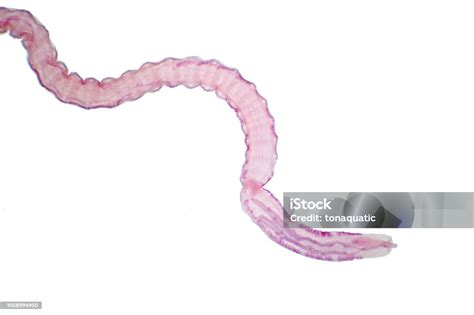 Tapeworm Under A Microscope