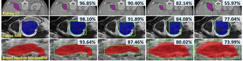 Robust Box Prompt Based Sam For Medical Image Segmentation Ai