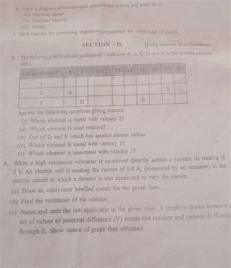 Draw A Diagram Of Human Male Reproductive Systen And Label On It Filo
