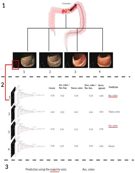 Graphical Abstract Polyp Based Post Processing Strategy Using The Download Scientific Diagram