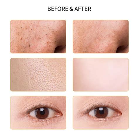 Badu Bg Ултразвукова йонна шпатула за лице Скрубер за кожа Пори Дълбоко почистващ масажор