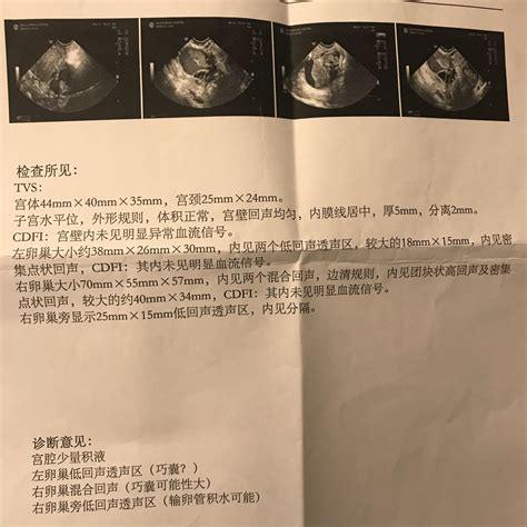 妇科超声检查图片 超声检查图片 伤感说说吧