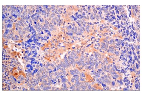Hypoxia Activation Ihc Antibody Sampler Kit Cell Signaling Technology