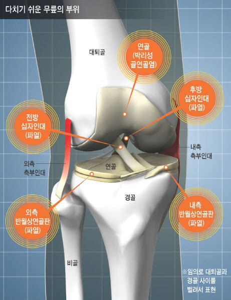 캐나다글루코사민 관절건강 내츄럴마스터 조인트마스터 글루코사민상어연골msm콘드로이친 네이버 블로그
