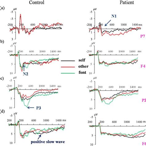 Comparisons Of Grand Averaged Waveforms Between The Download Scientific Diagram