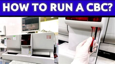 How To Use Automated Hematology Analyzer Abbott Cell Dyn Ruby Medical