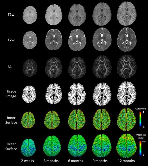 t1w t2w fa images tissue segmentation results by links wang et