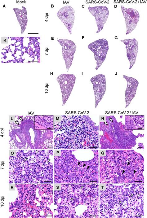 Histopathological Analysis Of Lungs Of Infected Hamsters Lung Sections Download Scientific