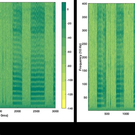 A Spectrogram Of Acquired Speech Signal The Frequency Sampling Rate