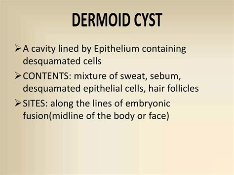 Dermoid Cyst Pptx