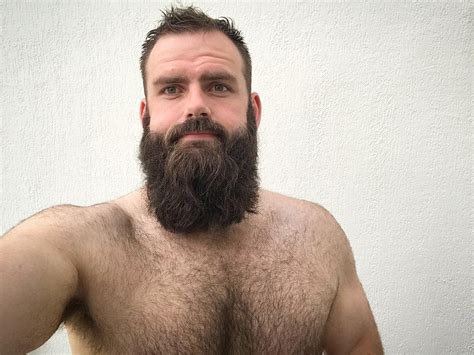 Male Pattern Baldness On Tumblr