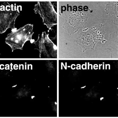 Localization Of F Actin β Catenin And N Cadherin To Cell Cell Contacts