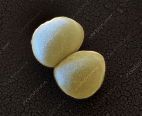 Staphylococcus Lugdunensis Bacteria Sem Stock Image C035 7896 Science Photo Library