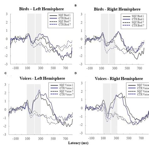 Auditory Event Related Potentials Ie N1 80 200 Ms P2 200 300