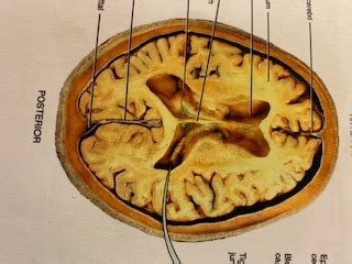 Choroid Plexus Diagram Quizlet