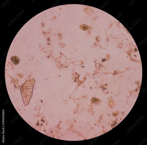 Giardia Lamblia Cysts And Trophozoite Form Muscle Fiber In Stool