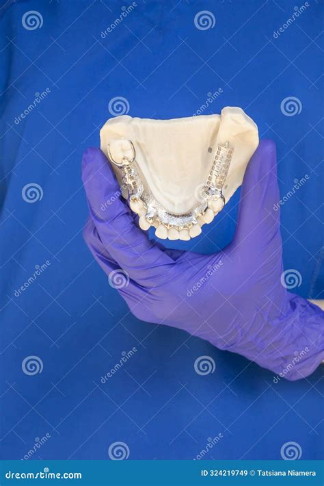 Lower Partial Denture With Attachments Royalty Free Stock Image 63390244