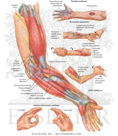 Radial Nerve Median And Radial Nerve Compression About The Elbow