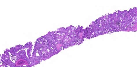 Lung Macrodissect Ai Indica Labs