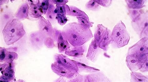 Microscope Gum Media At Stephen Jamerson Blog