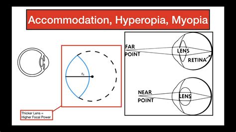 Accommodation Hyperopia Myopia Youtube
