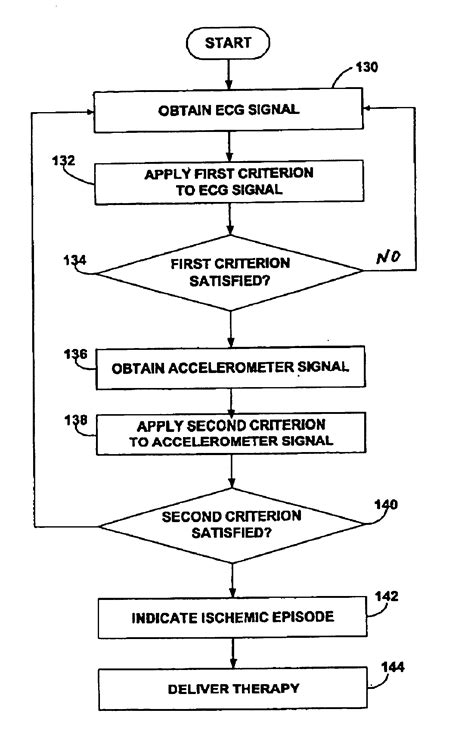 Ischemia Detection Eureka Patsnap