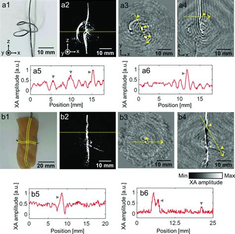 3d Volumetric X Ray Induced Acoustic Computed Tomography Of A Download Scientific Diagram