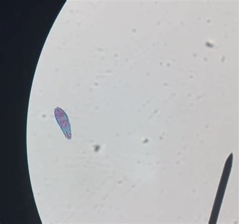 Prepared Slides Flashcards Quizlet