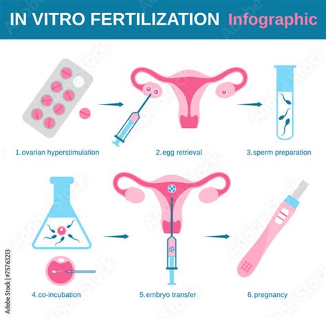 In Vitro Stock Vector Adobe Stock
