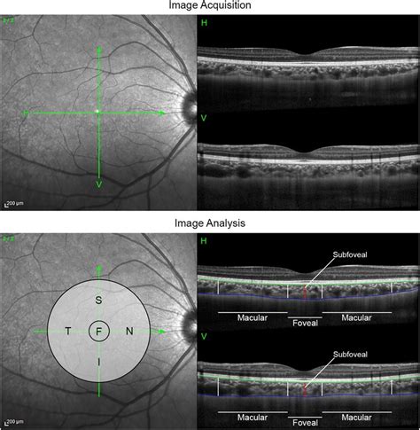 illustration of the oct scanning protocol and image analyses performed download scientific