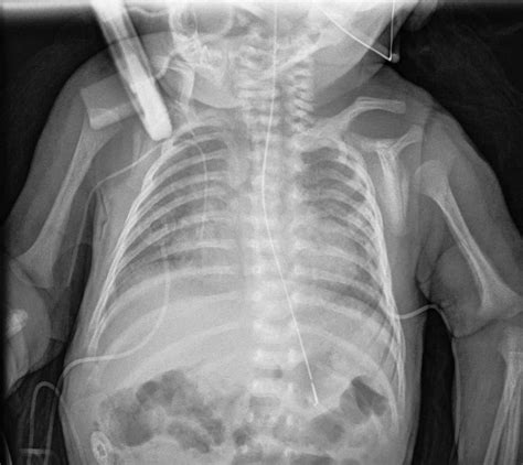 Msk Teaching Cases Radiology Case Collection