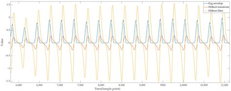 An Energy Efficient Ecg Processor Based On Hdwt And A Hybrid Classifier For Arrhythmia Detection