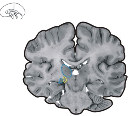 Visual Processing Flashcards Quizlet
