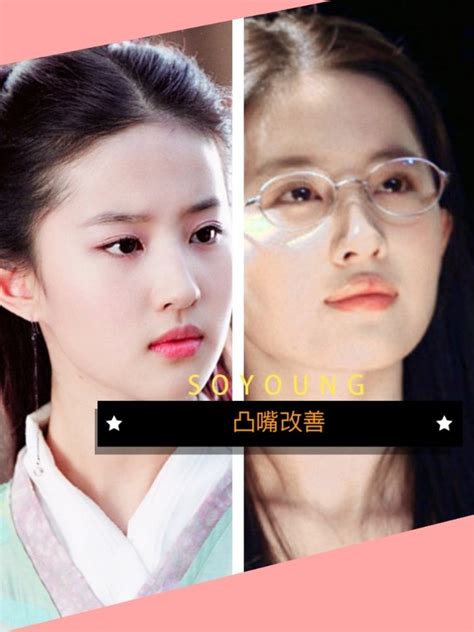 嘴凸的明星们侧脸图片 嘴凸的女明星 伤感说说吧