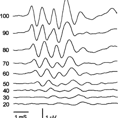 Auditory Brain Stem Response Abr Waveforms In Response To Tonal