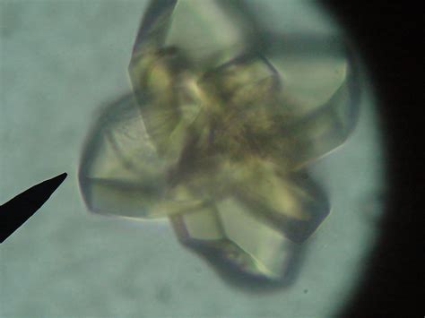 Blog De Mercedes Sedimento Urinario Fotos