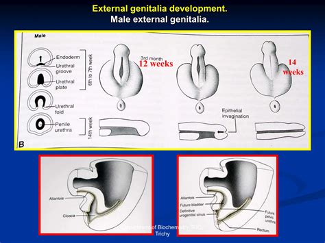 Sex Determination And Differentiationppt