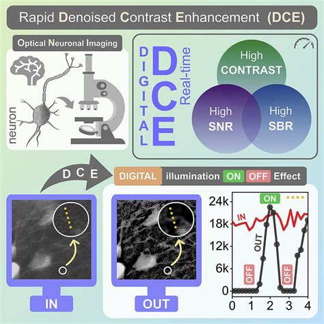 Graphical Abstract A Rapid Denoised Contrast Enhancement Method Download Scientific Diagram