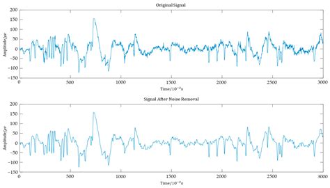 An Effective And Interpretable Sleep Stage Classification Approach Using Multi Domain