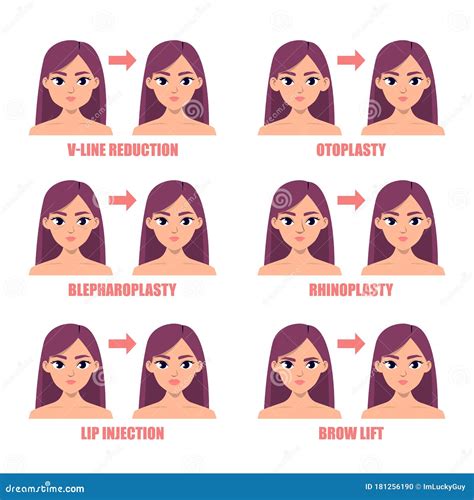 Types Of Plastic Surgery On The Face Stock Photo CartoonDealer Com 181256190