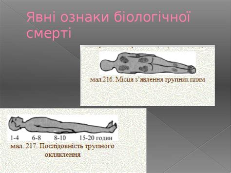 Смерть та її ознаки