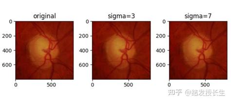 pytorch 图像增强教程 知乎