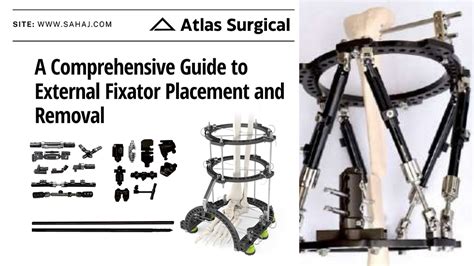 A Comprehensive Guide To External Fixator Placement And Removal