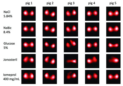 Shows Representative Eit Based Lung Perfusion Images Reconstructed From