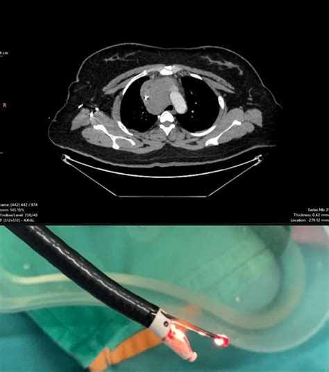 Sze Shyang Kho On Linkedin Cryoebus