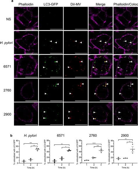 Mvs Colocalize With Lc3‐gfp Puncta A Single Confocal Plane Of A549