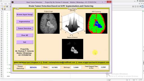 Brain Tumor Detection Using Som Segmentation Full Matlab Project Code