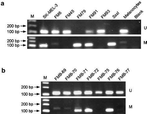Apc Promoter 1a Methylation In Melanoma Cell Lines A And Biopsies Download Scientific Diagram